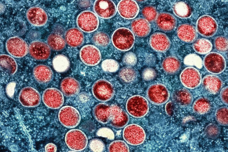 Varíola dos Macacos: o que é, sintomas e transmissão